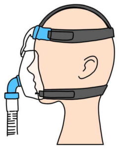 看護師ブログ：ナースねふな仕事と趣味 | NPPVマスクフィッティング